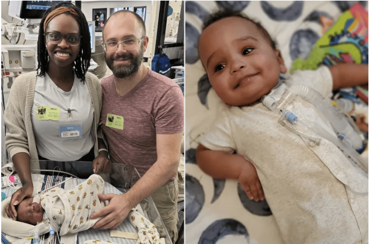 Born Twice: Baby With Rare Fatal Condition Defies The Odds